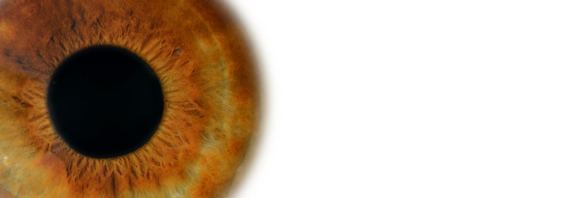 Allergie oculaire - Hôpital ophtalmique Jules-Gonin