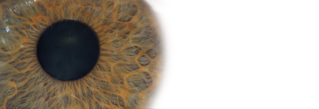 Uvéite - Hôpital ophtalmique Jules-Gonin